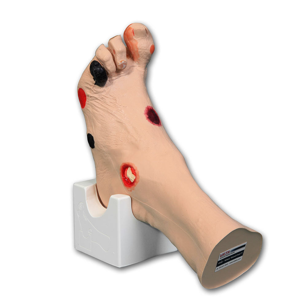 WILMA WOUND FOOT™ (Stand included) – VATAinc
