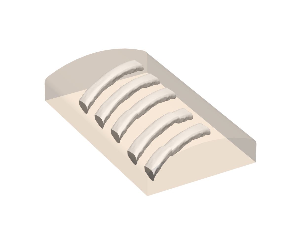ULTRASOUND PHANTOM - Bone Fracture – VATAinc